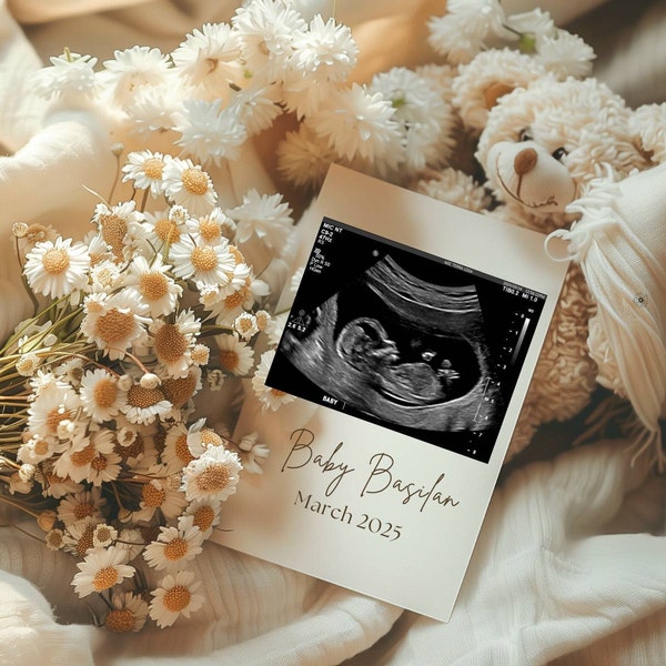 Daisy Flower Pregnancy Announcement Digital Download Boho Baby ...
