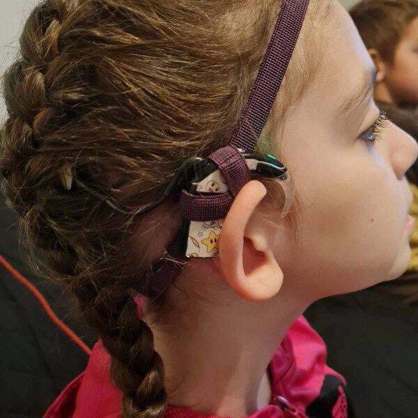 Cochlear Implant Skins | Cochlear Implant Stickers - Etsy