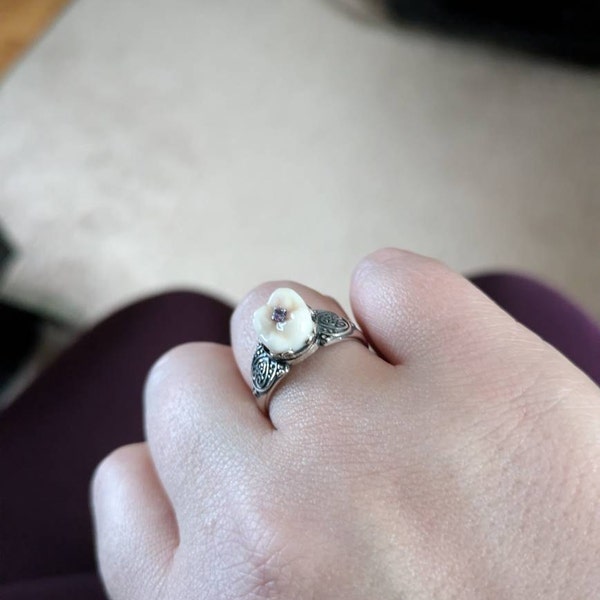 Trio Teeth Ring. Available With/ Without Braces Gem Cavities Also ...