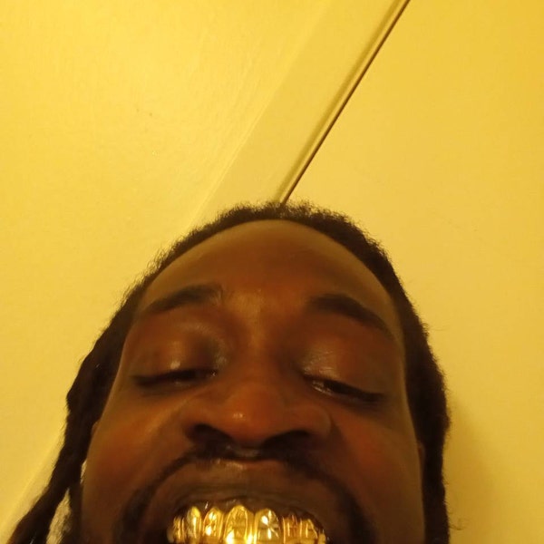 Custom Solid Gold Grillz / Permanent Cut / Deep Cut Custom Gold Grillz ...