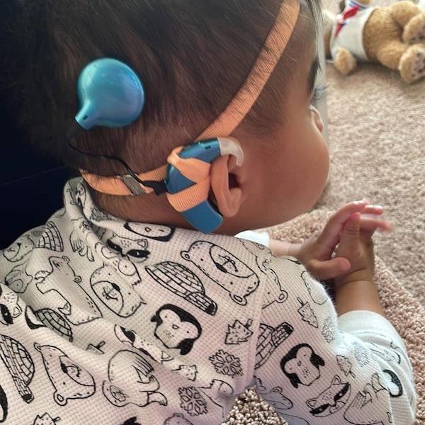 Cochlear Implant Headband - Ear Suspenders - Adjustable Sizing ...