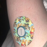 Premium Dexcom G6 Patch Plus Dexcom Transmitter Stickers No Lift ...