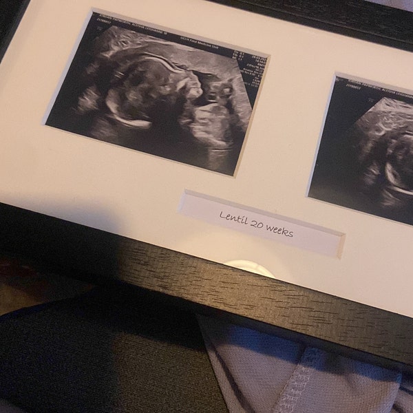 Baby Scan Photo Frame - Multi Aperture Frame for Two Scan Sized Photos ...