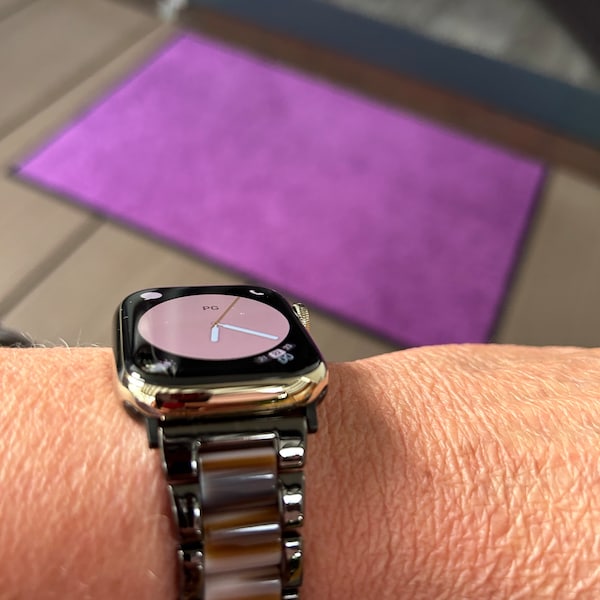 Arthritis MCP Hyperextension Splint Ring,full Hand Support Splint,thumb ...