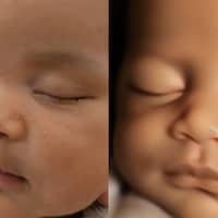 Ultrasaund 8k Baby Image 3d 4d 5d 8d Real View Baby AI Photo ...