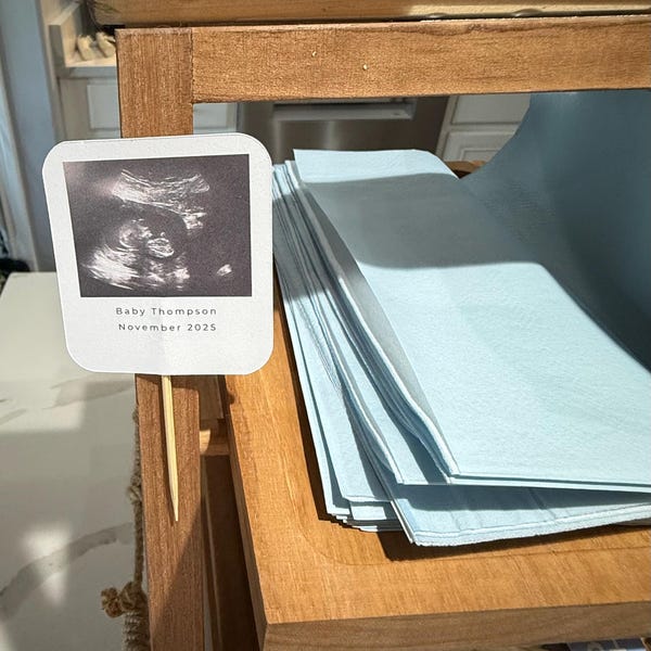Baby Shower Decorations | Ultrasound Confetti | Custom Decorations Baby ...
