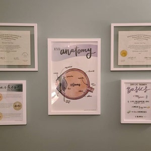 Dry Eye Therapy Dry Eye Poster Educational Optometry | Etsy