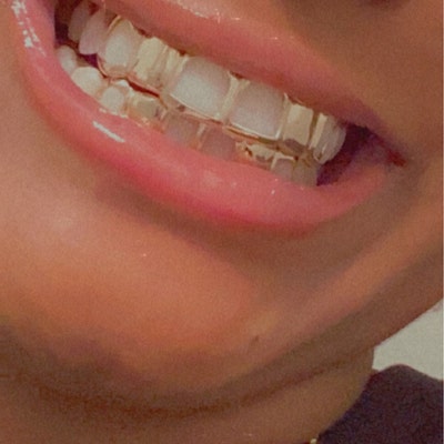 Custom Gold Grillz 10k Gold Teeth Open Face Yellow Grillz Real Gold ...