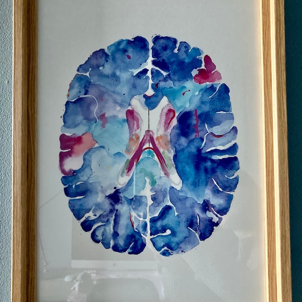 Brain Anatomy Radiology Neurology Art, Psychiatry Office Decor ...