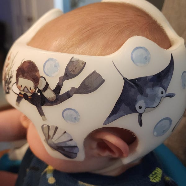 Custom Design Doc Band Decoration Decals, Stickers, Cranial Helmet ...