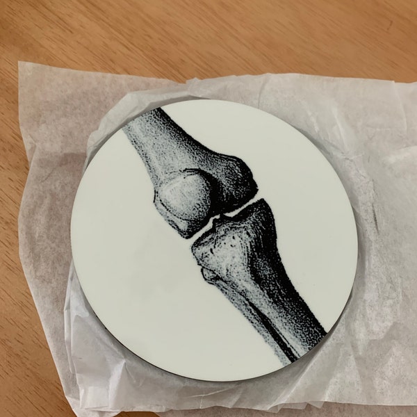 Joints Gift Anatomy Magnet Set Doctor Teacher Nurse Bones Arthritis Hip ...