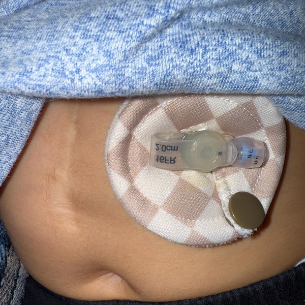 Floral G-tube Covers | Gtube Pads | Feeding Tube Pads | Mic-key Button ...