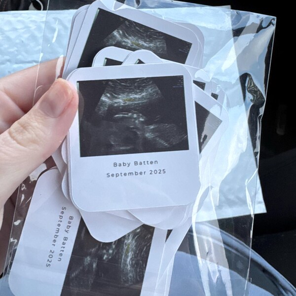 Baby Shower Decorations | Ultrasound Confetti | Custom Decorations Baby ...