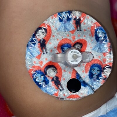 Cute Tubie Tape NG Tube Tape Gtube Tape Anime, Girls & Boys Oxygen ...