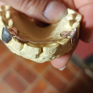 10K Gold Custom Grillz Two Front Teeth Real Solid Gold Double - Etsy