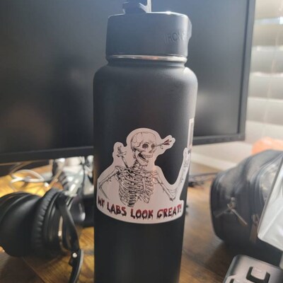 Ehlers Danlos Awareness Ribbon EDS Sticker Rare Disease Awareness - Etsy