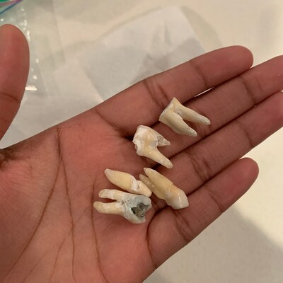 One Real Human Tooth Pendant Necklace - Etsy