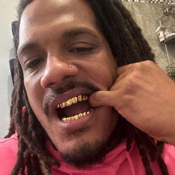 Handmade CUSTOM Gold Grillz Solid NPG Dental Gold Substitute Perm Cut ...