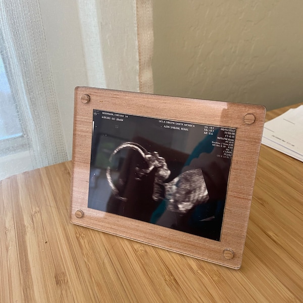 Personalized Ultrasound Frame With Baby Name Engraved - Sonogram ...