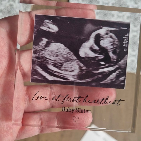 Baby Scan Photo | Baby Scan Frame | Baby Scan Gift | Ultrasound Print ...