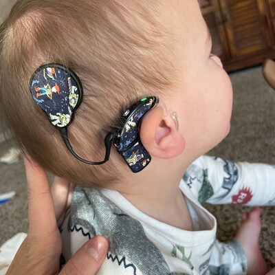 Construction Vinyl Cochlear N6 and N7 Skins - Etsy