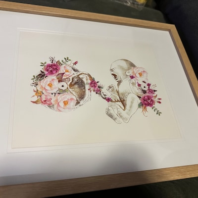 Meridian Tooth Chart, Tooth and Organ Relationship Chart, Acupuncture ...