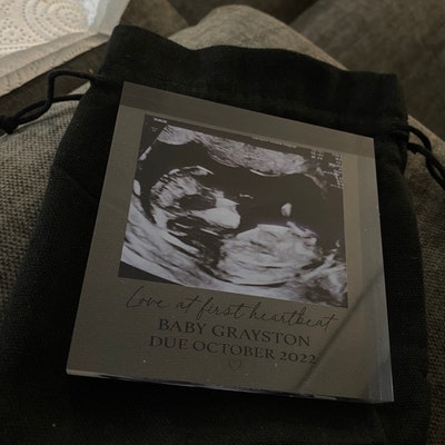 Baby Scan Photo Baby Scan Frame Baby Scan Gift Ultrasound Print Gift ...