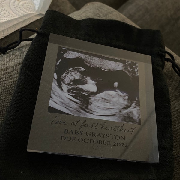 Baby Scan Photo | Baby Scan Frame | Baby Scan Gift | Ultrasound Print ...