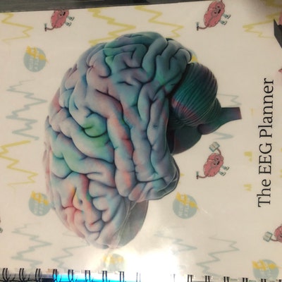 EEG Flashcards intro to Eeg Deck Electroneurodiagnostic Study Guide ...