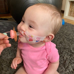 Ng tube Nasogastric or Oxygen tube adhesive tape 10 pack | Etsy