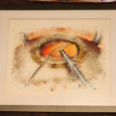 Eye Anatomy Art Print, Periorbital Cross-section Watercolor Style ...