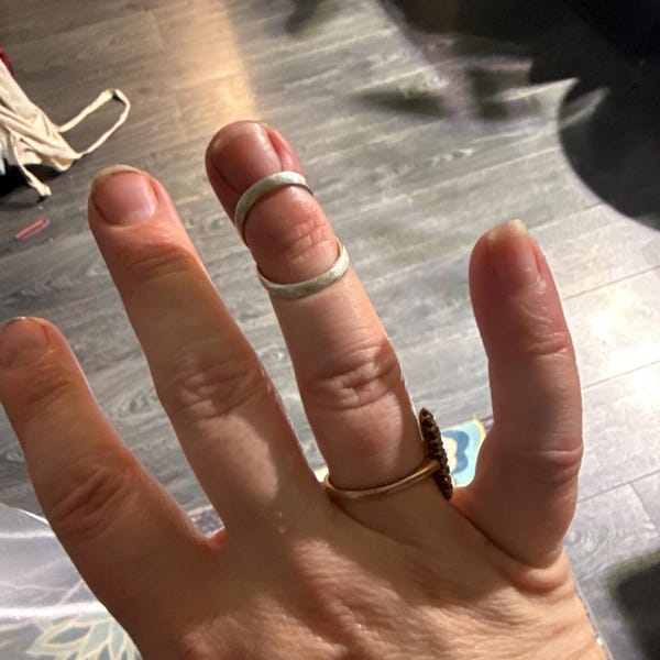 Mcpdeviation Splint Ring • MCP Deviation Splint Ring • Silver Splint ...