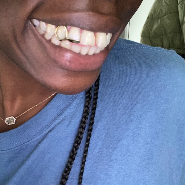 Gold Window/open Face Grillz Tooth Cap Worldwide Shipping White, Rose ...