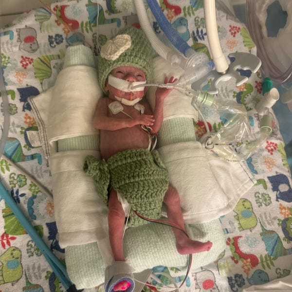 NICU Nano or Micro Preemie Pumpkin Costume, Overalls, Fits 2, 3, or 4 ...