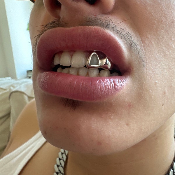 Gold Window/open Face Grillz Tooth Cap Worldwide Shipping White, Rose ...