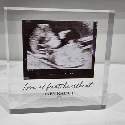 Baby Scan Photo Baby Scan Frame Baby Scan Gift Ultrasound Print Gift ...