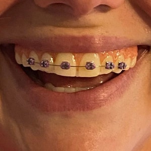 Werewolf / Wolf / Werewolf Teeth / Animal / Natural Wyndigu Teeth ...