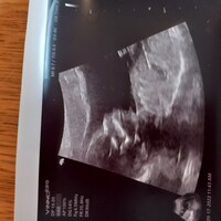 1908 Denim Bucket Hat - Etsy