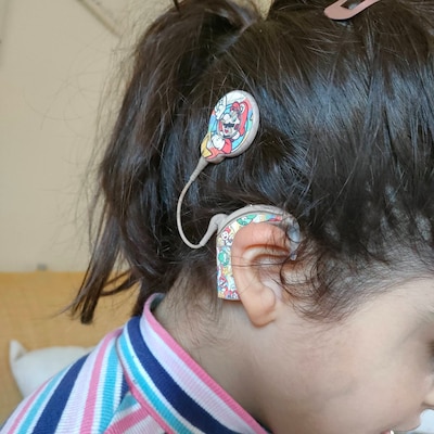 Cochlear Implant Skins Cochlear Implant Stickers - Etsy