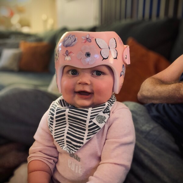 Custom Design Doc Band Decoration Decals, Stickers, Cranial Helmet ...