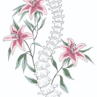 A4 Custom Hand Drawing Spinal Fusion / Scoliosis (one Line Drawing ...