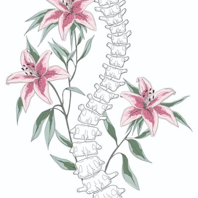 Custom Scoliosis / Spinal Fusion Digital Art Print PRINTABLE - Etsy UK