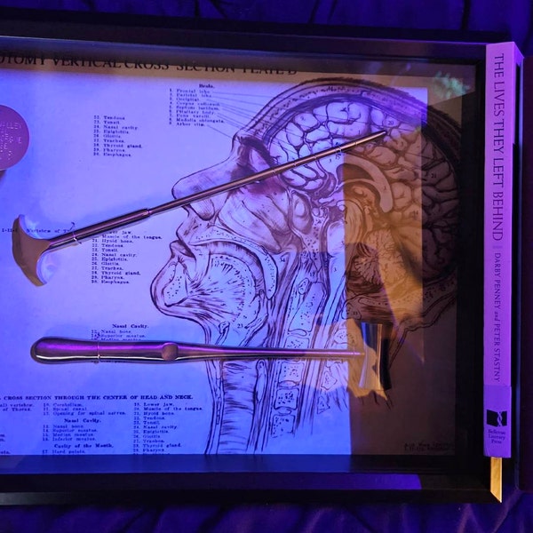 BESTSELLER! Lobotomy Shadowbox Display Large - Etsy