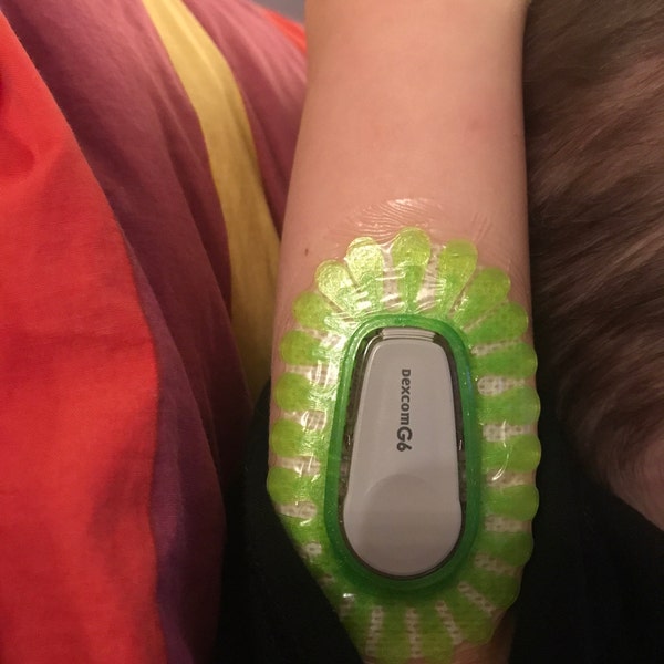 Flexible Dexcom G6 Cover - Holds and Protects Sensor and Patch ( Over ...