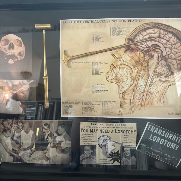 Lobotomy Orbitoclast & Hammer Surgical Medical Tools Shadowbox With ...