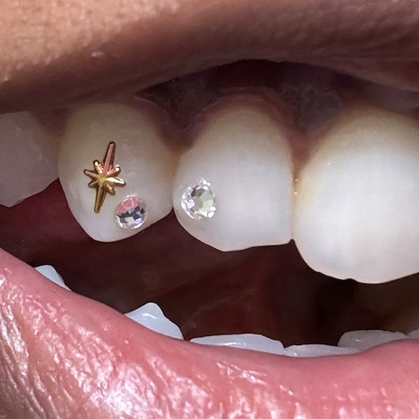 Gold Sparkle Tooth Gem - Etsy