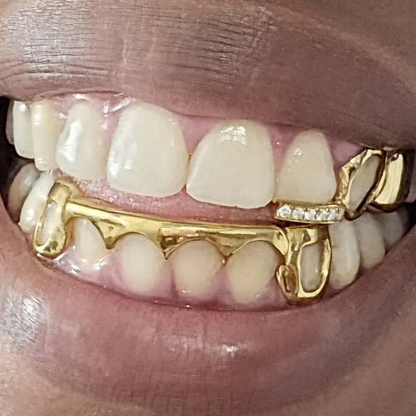 Custom 10 Piece Grillz Set With Trillion Tips and Open Windows in Two ...