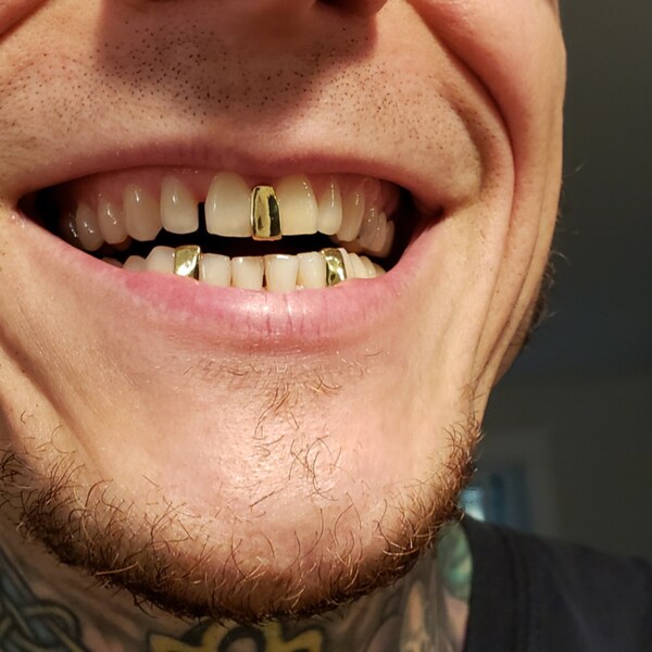 Real Solid 10K Gold or 14K or 18K Gold Single Gap Grill Custom Fit ...