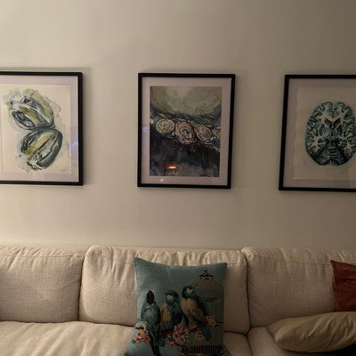 Blue Spine Print Series of 3 Anatomy Art Set 3 Watercolor - Etsy