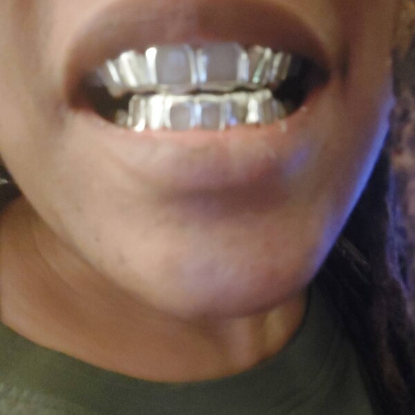 Sterling Silver Grillz 925 Custom Silver Teeth Real Open Face Silver ...